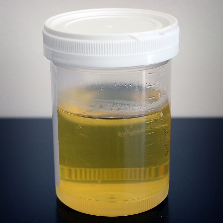 7.4 Specimen Collection – Personal Care Skills for Health Care Assistants