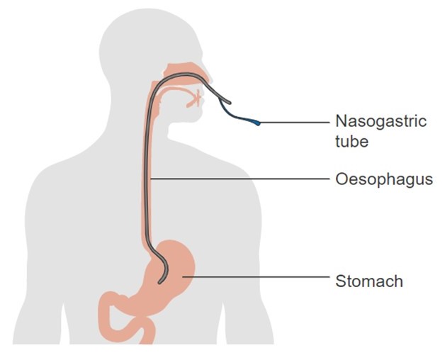 6.4 Special Diets – Personal Care Skills for Health Care Assistants